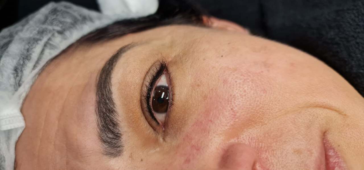 Micro EyeLiner: Conheça o procedimento que promete ser a nova sensação ...